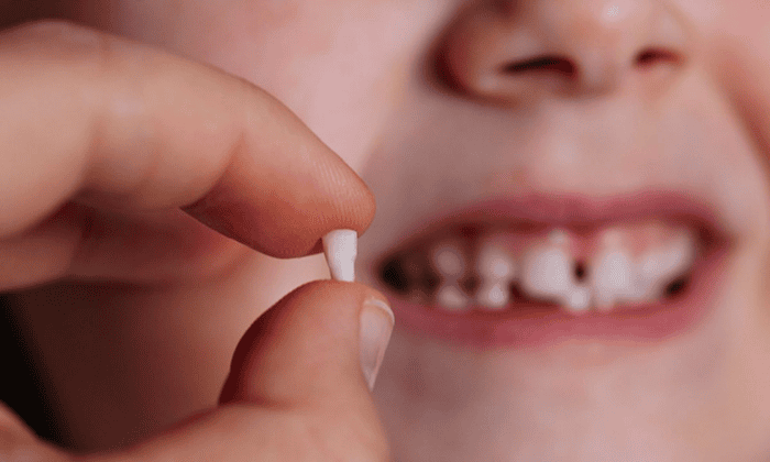 Primary Teeth: Eruption, Exfoliation & Dental Care Guide